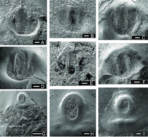Nasohypophyseal Region Of The Species Of Tremataspis A C T Schmidti Download Scientific
