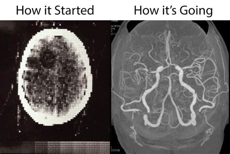 Ctisus Linkedin‘de Happy 50th Birthday To The First Ct Scan