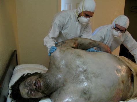 Decomposing Body Vincent Van Dyke Effects