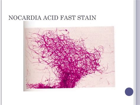 Actinomycetes Ppt Ear Nose And Throat Conditions Diseases And