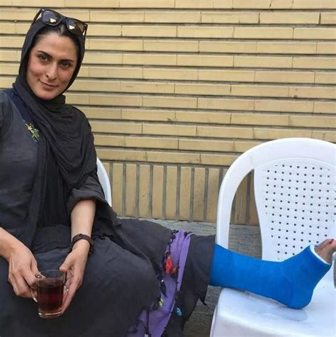 ژست بازیگر زن نیسان آبی با پای شکسته