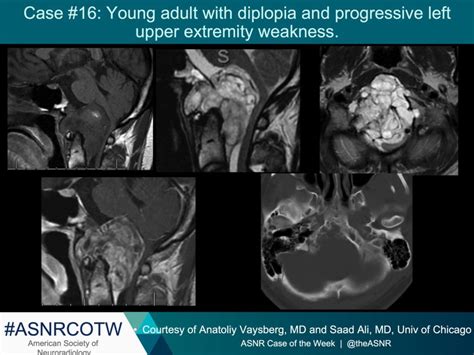 ASNR Case Of The Week Case 16 American Society Of Neuroradiology