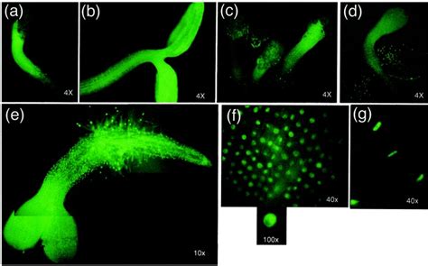 Fluorescence Microscopy Detection Of Gfp And Ntset1 Gfp In Transgenic