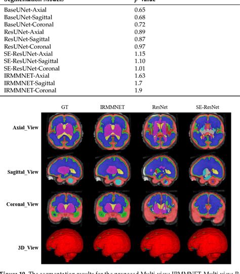 Figure 1 From Effective Approaches To Fetal Brain Segmentation In Mri