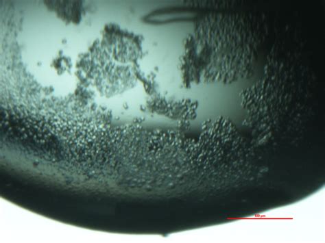 What Is This Skin Formation In My Crystallization Screens