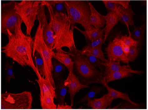 免疫荧光染色技术 知乎