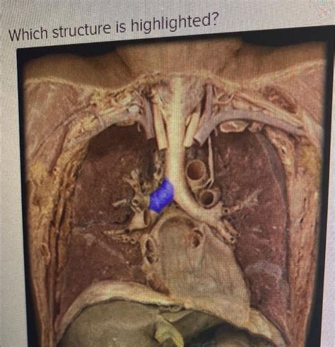 Solved Which Structure Is Highlighted Left Main Bronchus Solved Which Structure Is Highlighted Left Main Bronchus