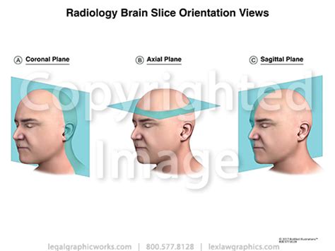 brain slice orientation views legal graphicworks