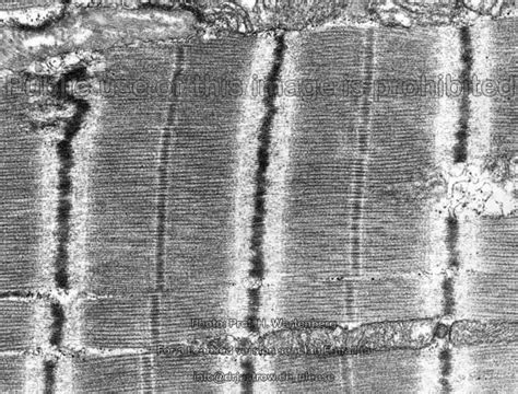 Heart Muscle Drjastrows Electron Microscopic Atlas
