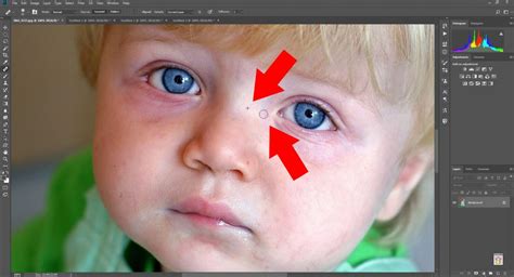 Remove Blemishes From A Face Using Photoshop Quickly And Easily