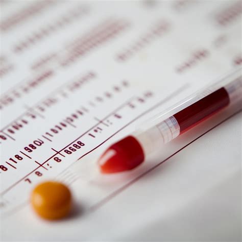 A Closeup Of A Cholesterol Test Strip And Blood Sample For Home Testing