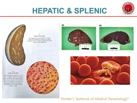 Pathogenesis Of Malaria Pptx Pathogenesis Of Malaria Pptx