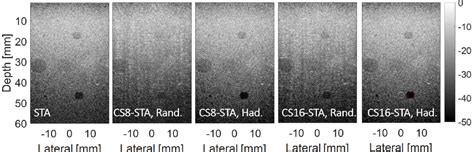 The B Mode Images Of Different Methods The Red And White Circles Download Scientific Diagram