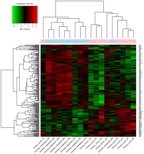 Identification Of Candidate Biomarkers For Epithelial Ovarian Cancer Metastasis Using Microarray