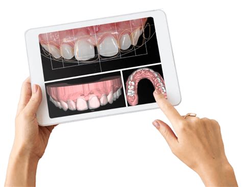 Цифровое 3д сканирование и диагностика в подарок