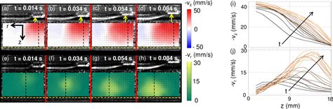 Figure 1 From Dynamic Shear Jamming In Dense Granular Suspensions Under Extension Semantic