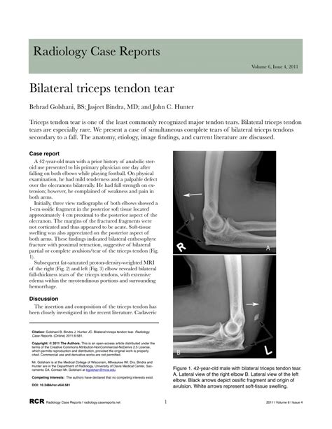 Pdf Bilateral Triceps Tendon Tear