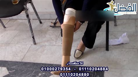 كيف ترتدى الطرف الصناعى بطريقة صحيحة فى اقل من دقيقة بسهولة ؟؟ Youtube