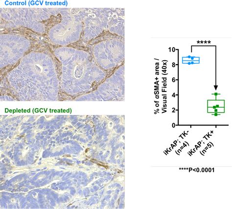 Figure 7 From Stromal Fibroblasts Restrain The Rate Of Colon Cancer
