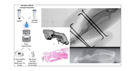 Representative Images From The Tibia Defect Model Showing The Extent Of My Xxx Hot Girl