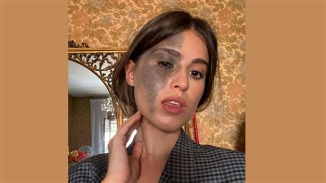 Carlotta Bertotti Ospite A Le Iene Commuove Tutti Bigodino