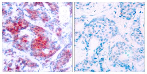Stat4 Phospho Tyr693 Rabbit Pab 产品 Immunoway 中文官网