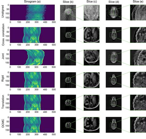 Figure 5 From A General Image Misalignment Correction Method For