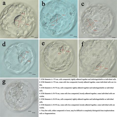 Photographic Example For Each Icm Grade The Icm Grades Of A B C D