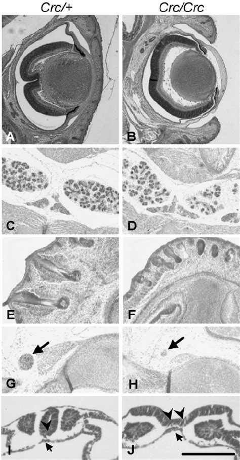 Phenotypic Abnormalities In Crccrc Mutants Revealed In Histological Download Scientific