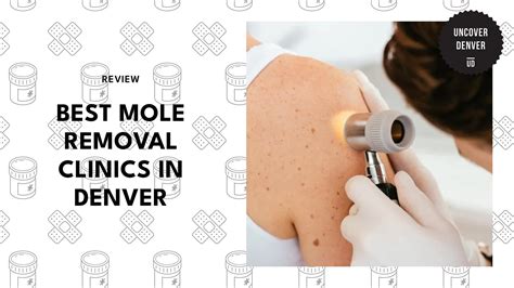 Top 5 Safe Mole Removal Clinics In Denver 2026