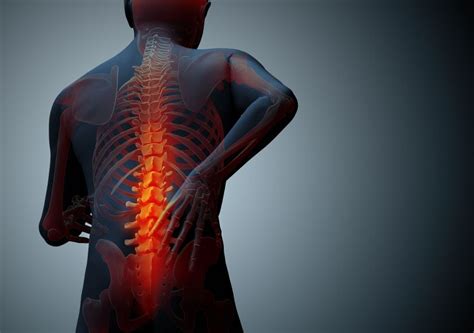 3 Reasons To Consider Minimally Invasive Back Surgery Artofit