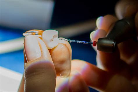 Are You Worried About Your Root Canal Procedure Click Here