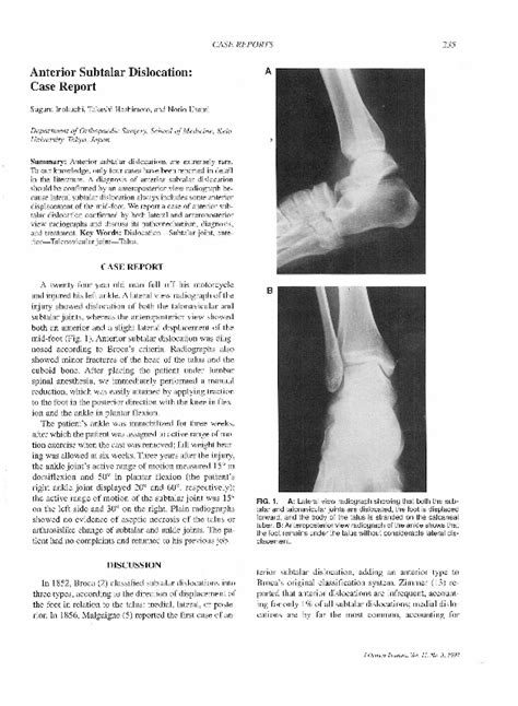 Pdf Anterior Subtalar Dislocation Case Report