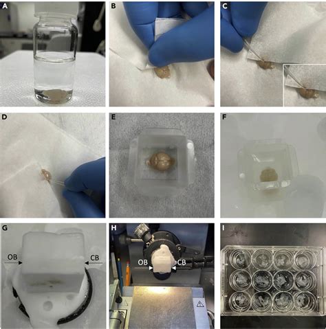 Brain Saturation In Sucrose And O C T Embedding A Brain At The