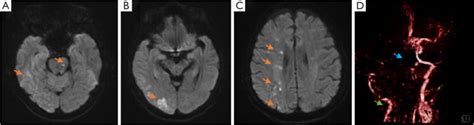 Diagnostic Brain Magnetic Resonance Imaging And Angiography Multiple Download Scientific