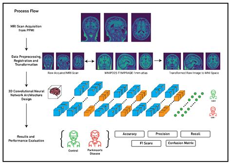 Detection Of Parkinsons Disease From 3t T1 Weighted Mri Scans Using 3d Convolutional Neural Network