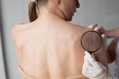 We Хэт Хямд хувцаснууд ихэвчлэн дараах хорт хавдрыг үүсгэдэг нь батлагдсан болно Та нар минь