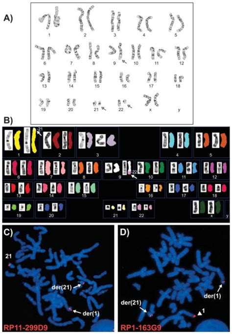 Overexpression Of Prdm16 In The Presence And Absence Of The Runx1 Prdm16 Fusion Gene In Myeloid