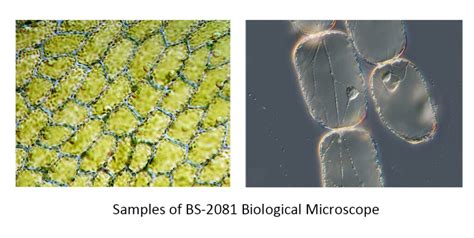 Whats The Difference Between Electron Microscopes And Optical Microscopes