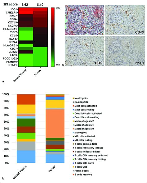Tumor Inflammation Signature Score Cibersortx And Pathological Download Scientific Diagram