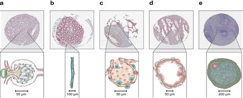 Exemplary Tissue Microarray Cores With Ftu Segmentations Outlined In Download Scientific