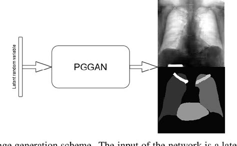 Figure 1 From A Multi Stage Gan For Multi Organ Chest X Ray Image Generation And Segmentation