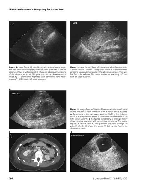 Trauma Scan Pdf Trauma Scan Pdf