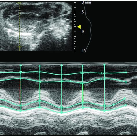 A Representative Image Showing Probe Positioning To Obtain Download Scientific Diagram