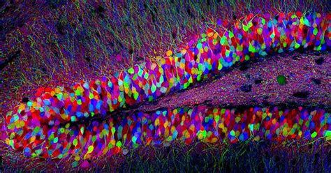 Colours Of The Brainbow Imgur