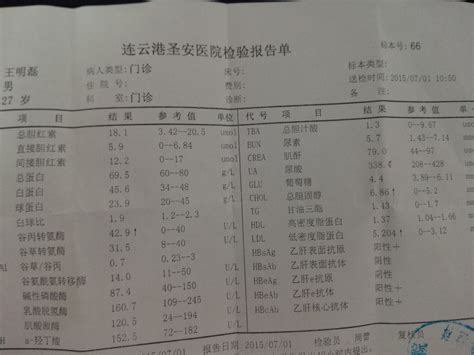 抽血化验能查出艾滋病吗 去医院验血能检测出艾滋病吗