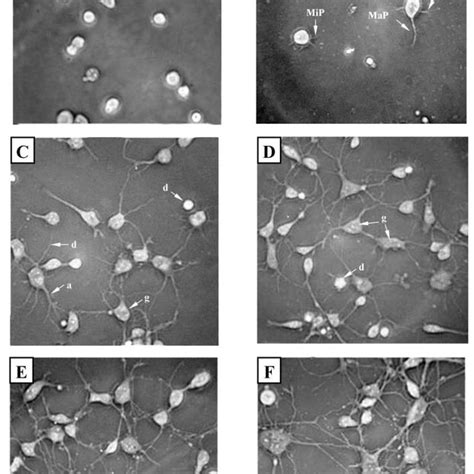 Growth Of Mouse Prefrontal Cerebrocortical Neurons In Culture X Download Scientific