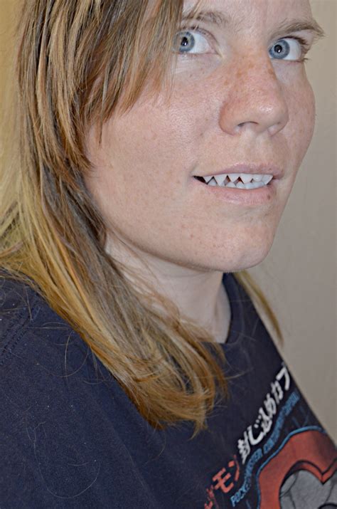 A World Of Creativity Polymorph Teeth Walkthrough