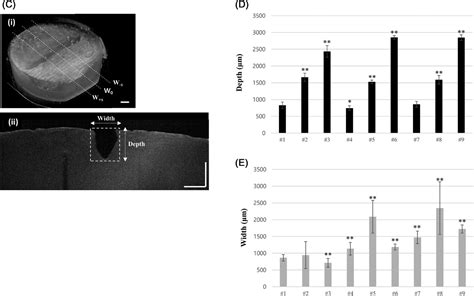 a novel optical coherence tomography‐based in vitro method of anti