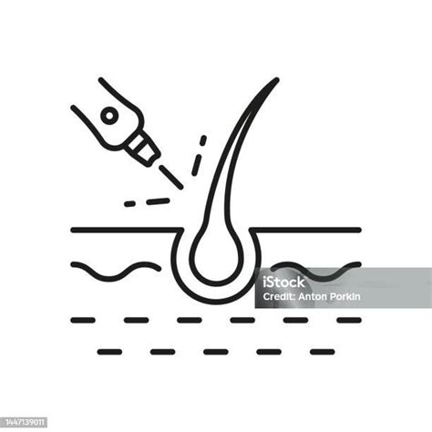 머리 레이저 제거 라인 아이콘입니다 제모 탈모 치료 선형 픽토그램 전문 뷰티 피부과 절차 개요 아이콘입니다 편집 가능한 획 고립된 벡터 그림 레이저에 대한 스톡 벡터 아트